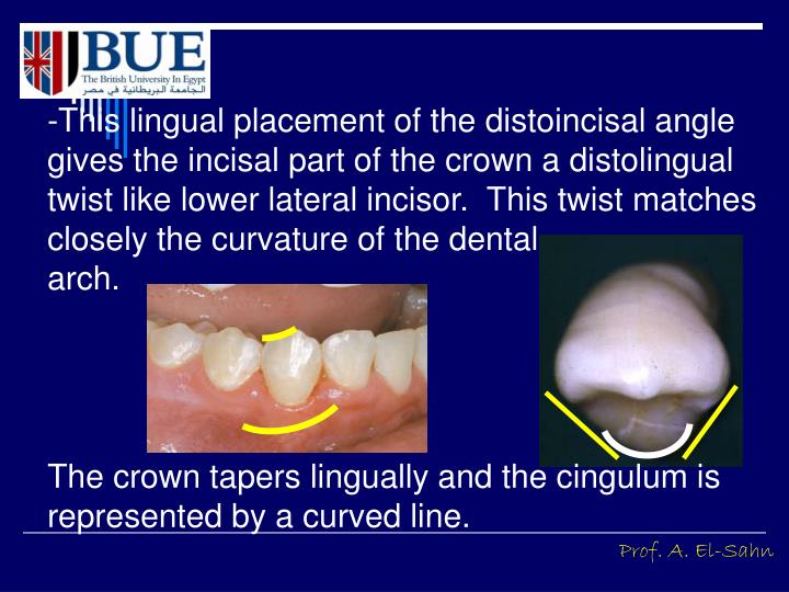 PPT - MANDIBULAR CANINE PowerPoint Presentation - ID:7024933