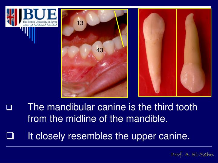 PPT - MANDIBULAR CANINE PowerPoint Presentation - ID:7024933