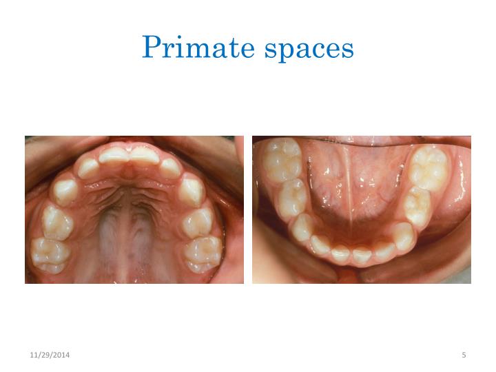 PPT - Crowding and Spacing PowerPoint Presentation - ID:7025398