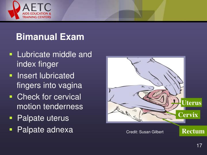 PPT - Cervical Cancer Screening in HIV-Infected Women: Pap Smears and ...