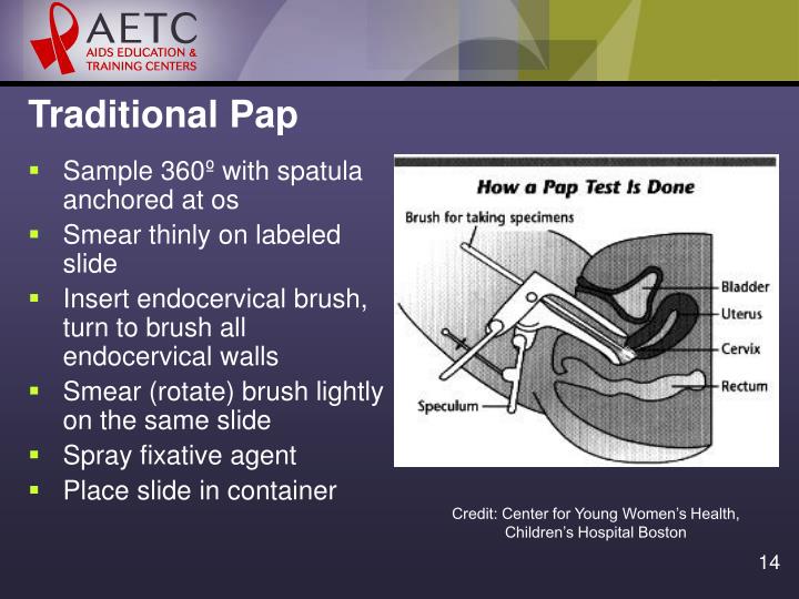 PPT - Cervical Cancer Screening in HIV-Infected Women: Pap Smears and ...