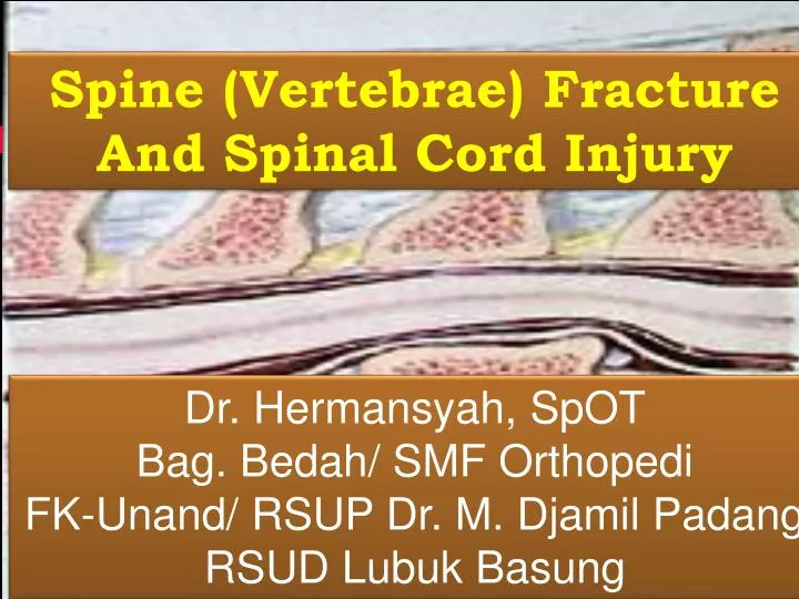 PPT - Spine (Vertebrae) Fracture And Spinal Cord Injury PowerPoint ...