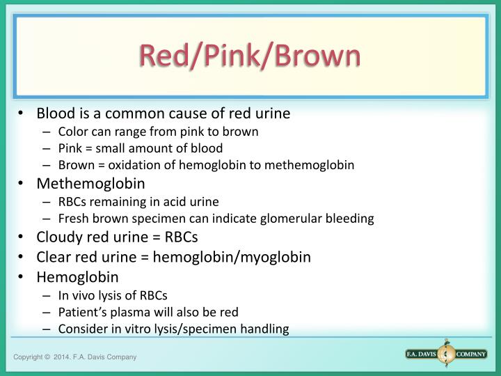 PPT - PHYSICAL EXAMINATION OF URINE PowerPoint Presentation - ID:7036624
