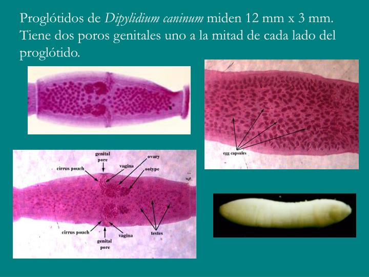 PPT - Diphyllobothriasis PowerPoint Presentation - ID:7038504