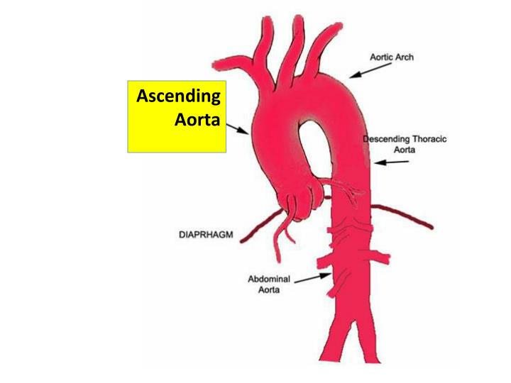 PPT - Sheep Heart PowerPoint Presentation - ID:7043500
