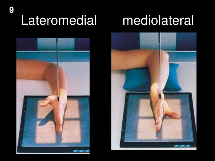PPT - More upper extremity PowerPoint Presentation - ID:7050318
