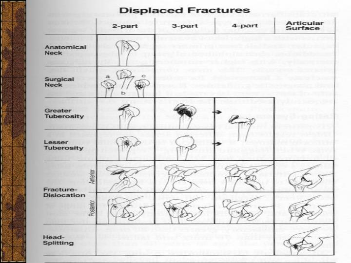 PPT - FRACTURES OF THE PROXIMAL HUMERUS PowerPoint Presentation - ID ...