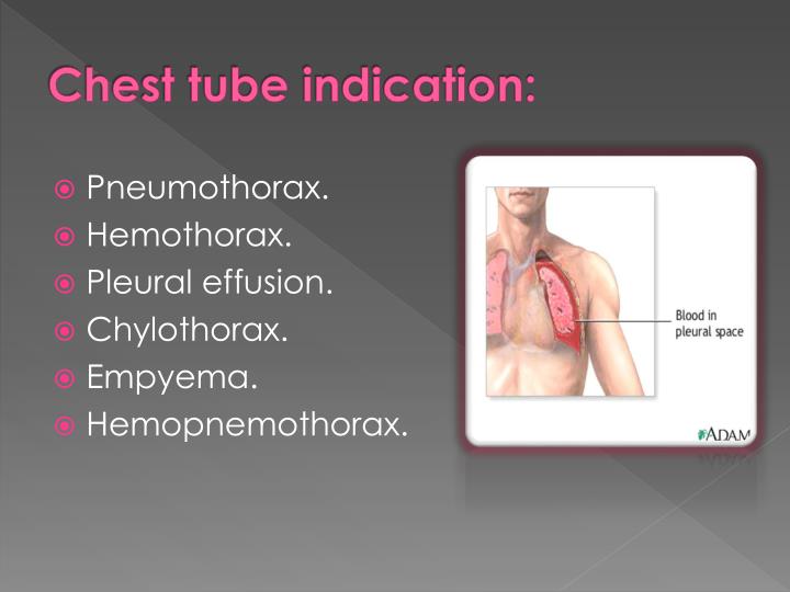 PPT - Chest Tube PowerPoint Presentation - ID:7066708