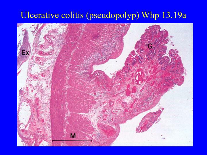 PPT - Diseases of the gastrointestinal tract and liver PowerPoint ...