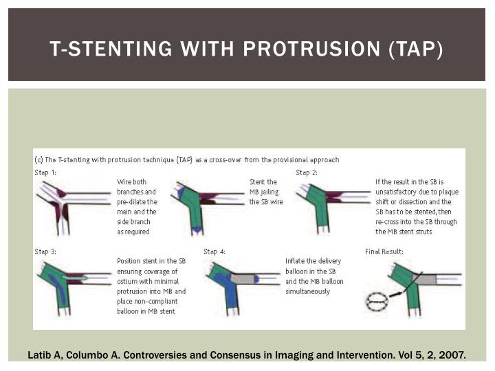 PPT - Bifurcation Stenting: A primer PowerPoint Presentation - ID:7078253