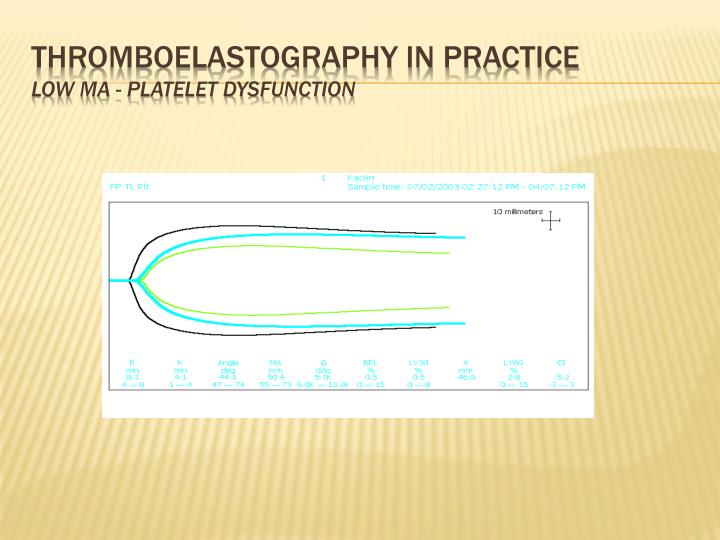 PPT - THROMBOELASTOGRAPHY PowerPoint Presentation - ID:7081622