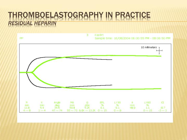 PPT - THROMBOELASTOGRAPHY PowerPoint Presentation - ID:7081622