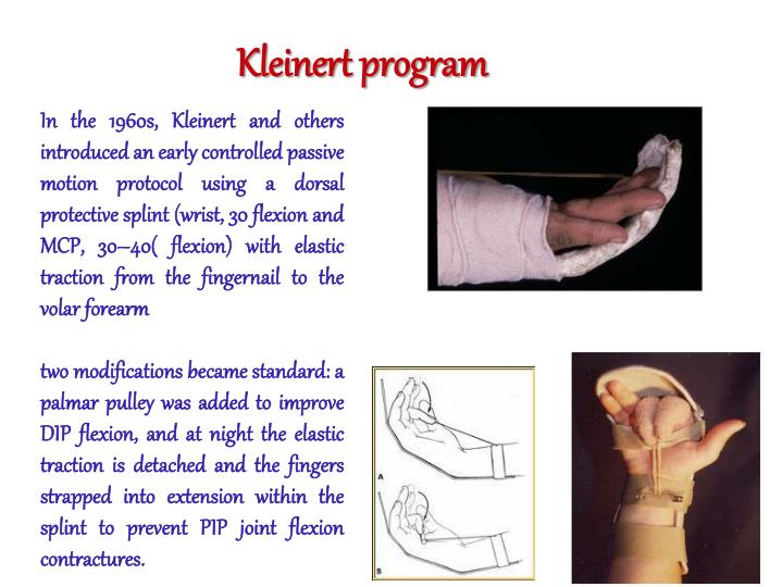 PPT - Cut Wrist & Flexor tendon injury PowerPoint Presentation - ID:7081690