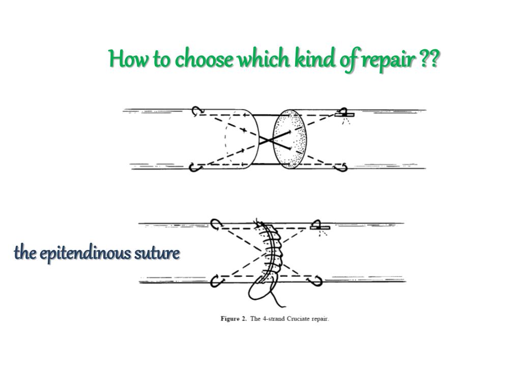PPT - Cut Wrist & Flexor tendon injury PowerPoint Presentation, free ...