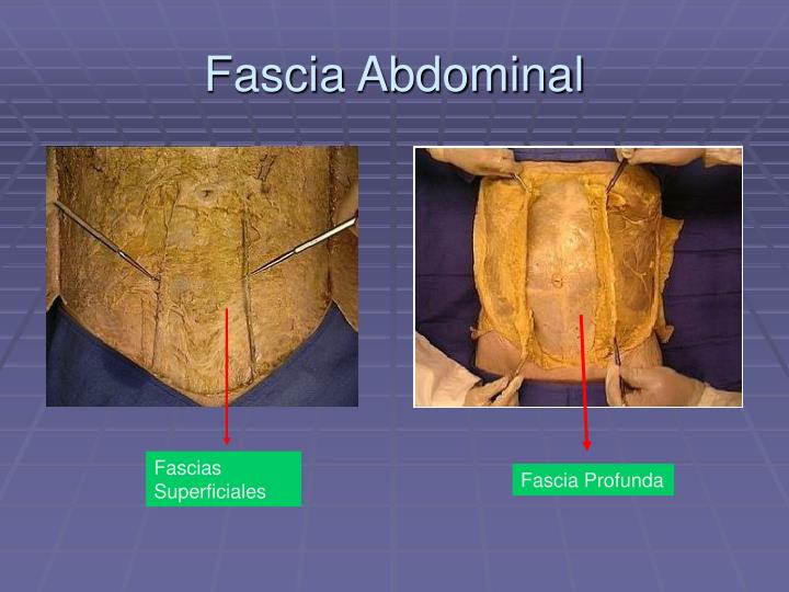 PPT - Diafragma. Abdomen PowerPoint Presentation - ID:7082099