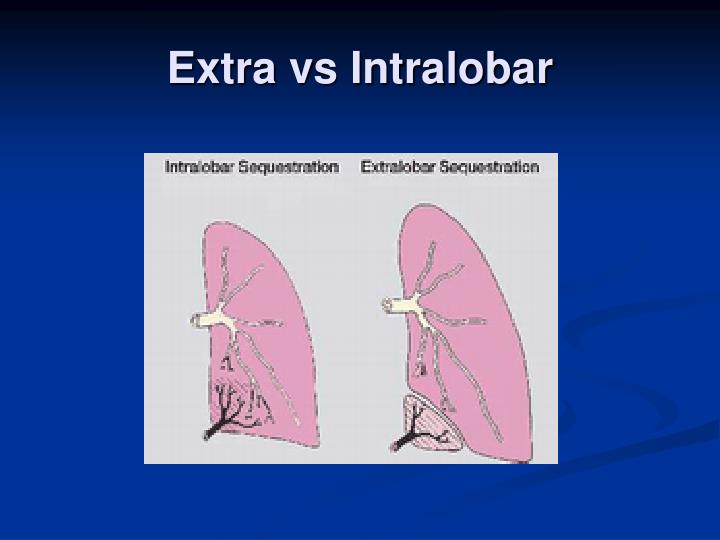 PPT - Pulmonary Mass in a Neonate PowerPoint Presentation - ID:7084310
