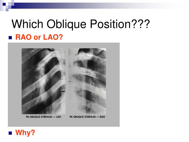 PPT - Bony Thorax PowerPoint Presentation - ID:7087072