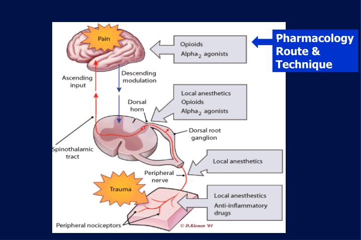 PPT - Acute Pain ( Postoperative ) Management PowerPoint Presentation ...