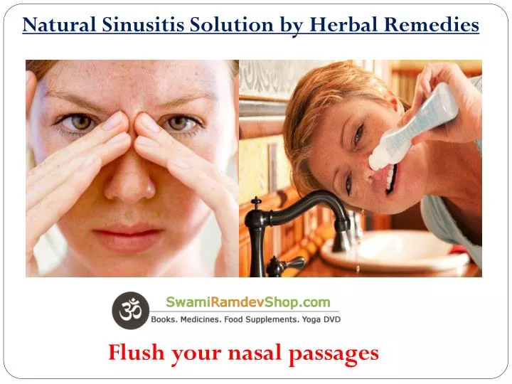 PPT - Natural Sinusitis Solution by Herbal Remedies PowerPoint ...